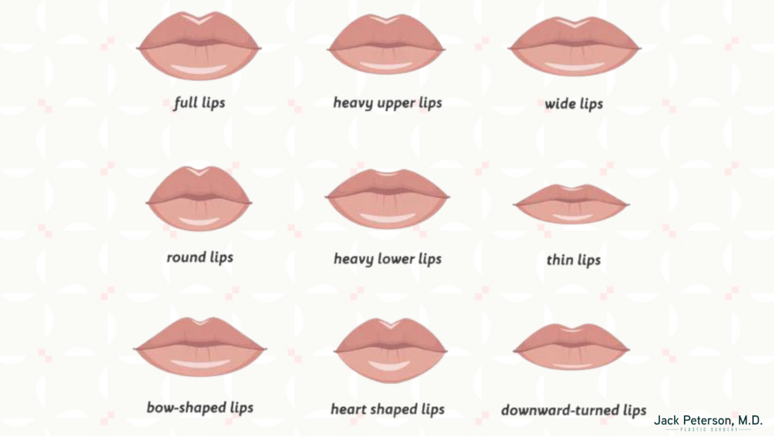 Unlocking the Secrets of 9 Lip Shapes: Creating Aesthetic Harmony ...