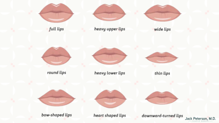 Unlocking the Secrets of 9 Lip Shapes: Creating Aesthetic Harmony ...